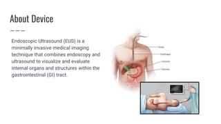 Atharva Patil MTech IIT Hyderabad Medical devices - Endoscopic ...