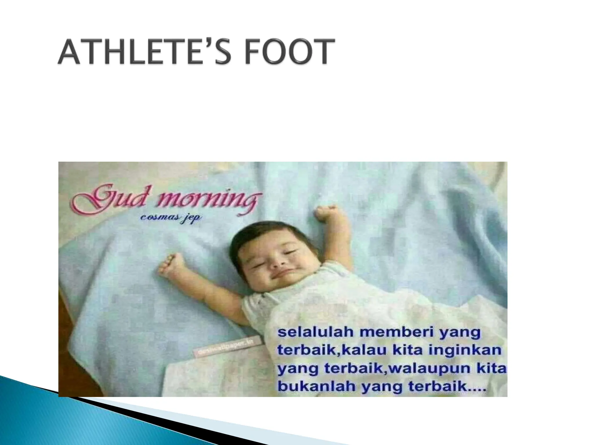 Athelete Foot Symptoms, Care and Prevention .pptx