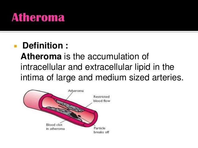 Atheroma
