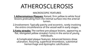 Detailed Histopathology of Atherosclerosis and Myocardial Infarction ...