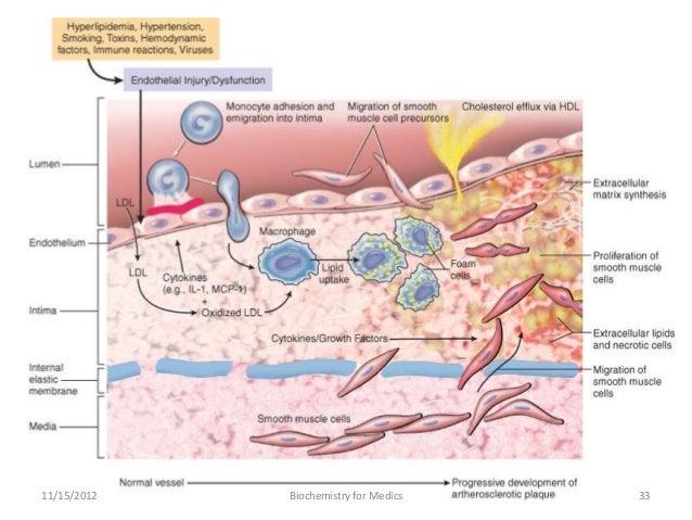 Atherosclerosis