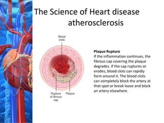 Atherosclerosis | PPT
