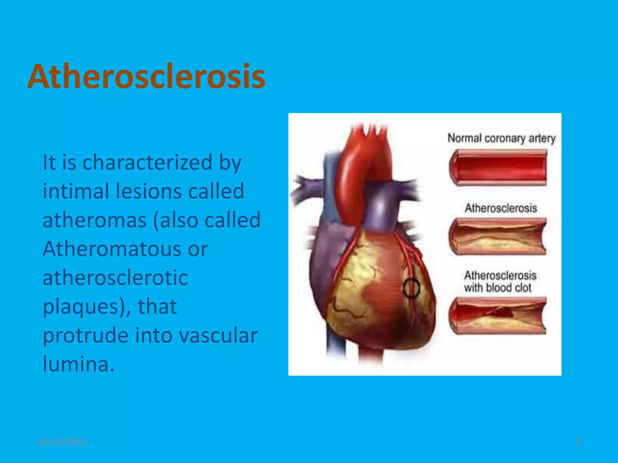 Atherosclerosis | PPTX