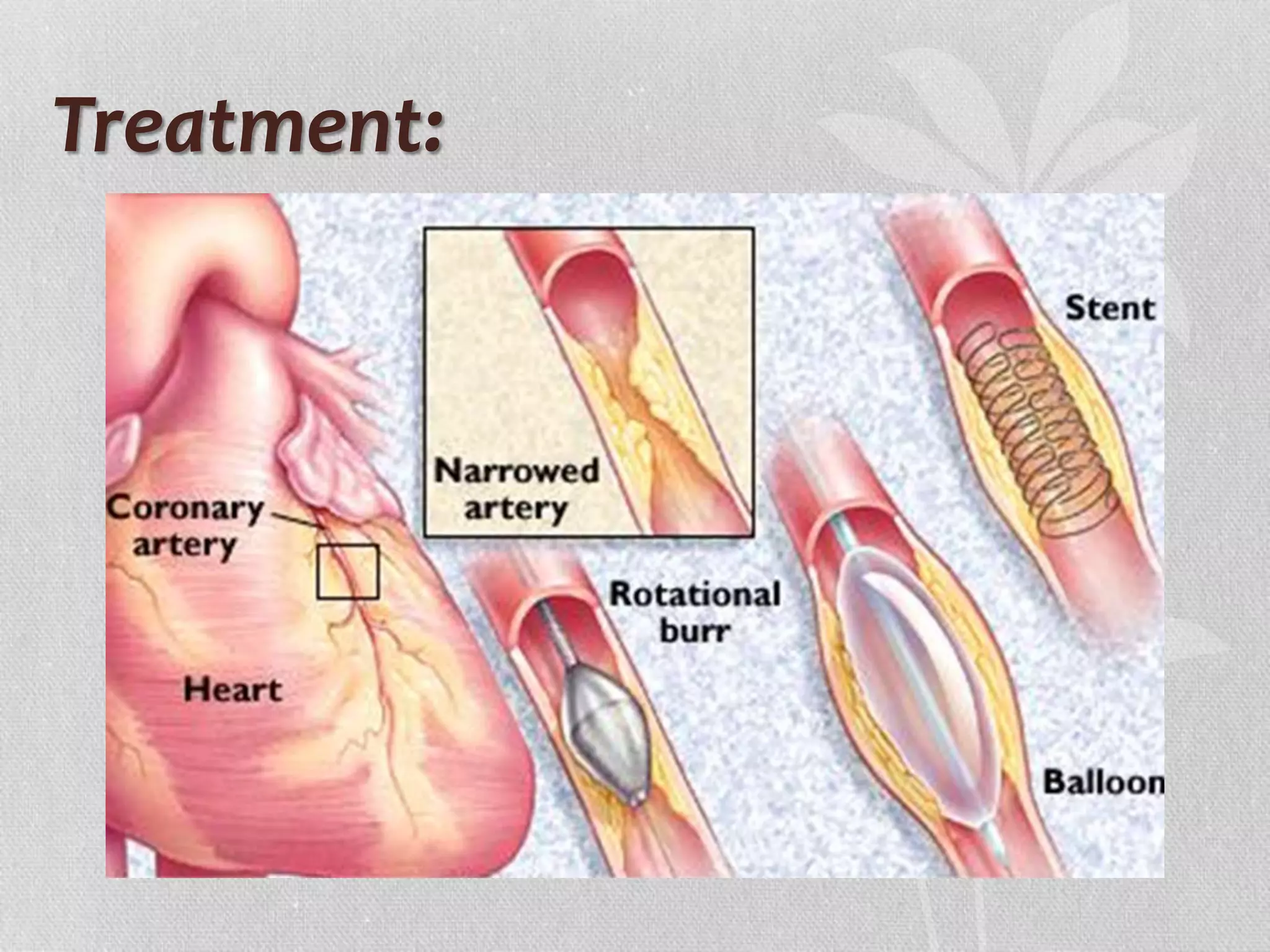 Atherosclerosis | PPTX
