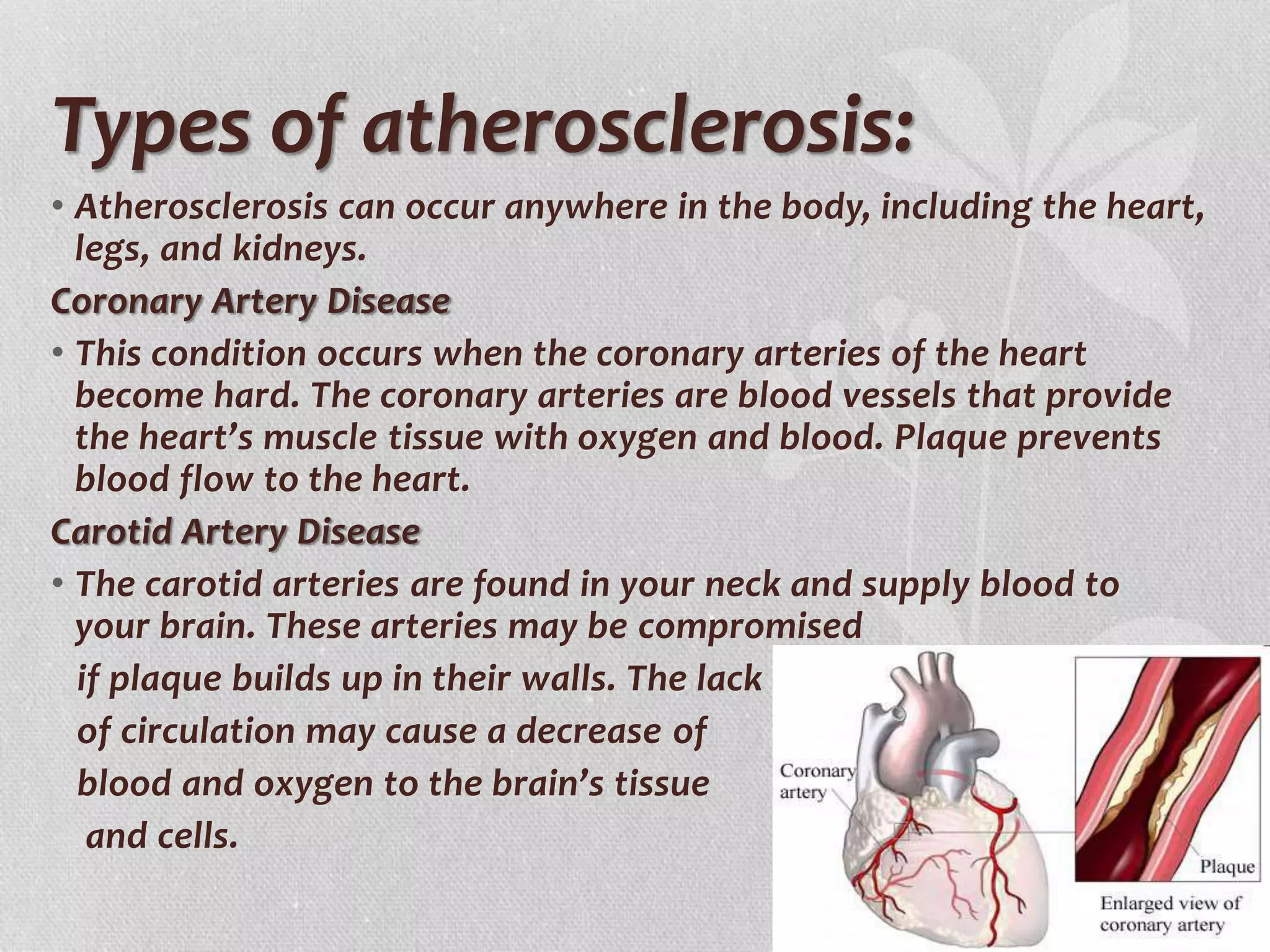 Atherosclerosis | PPTX