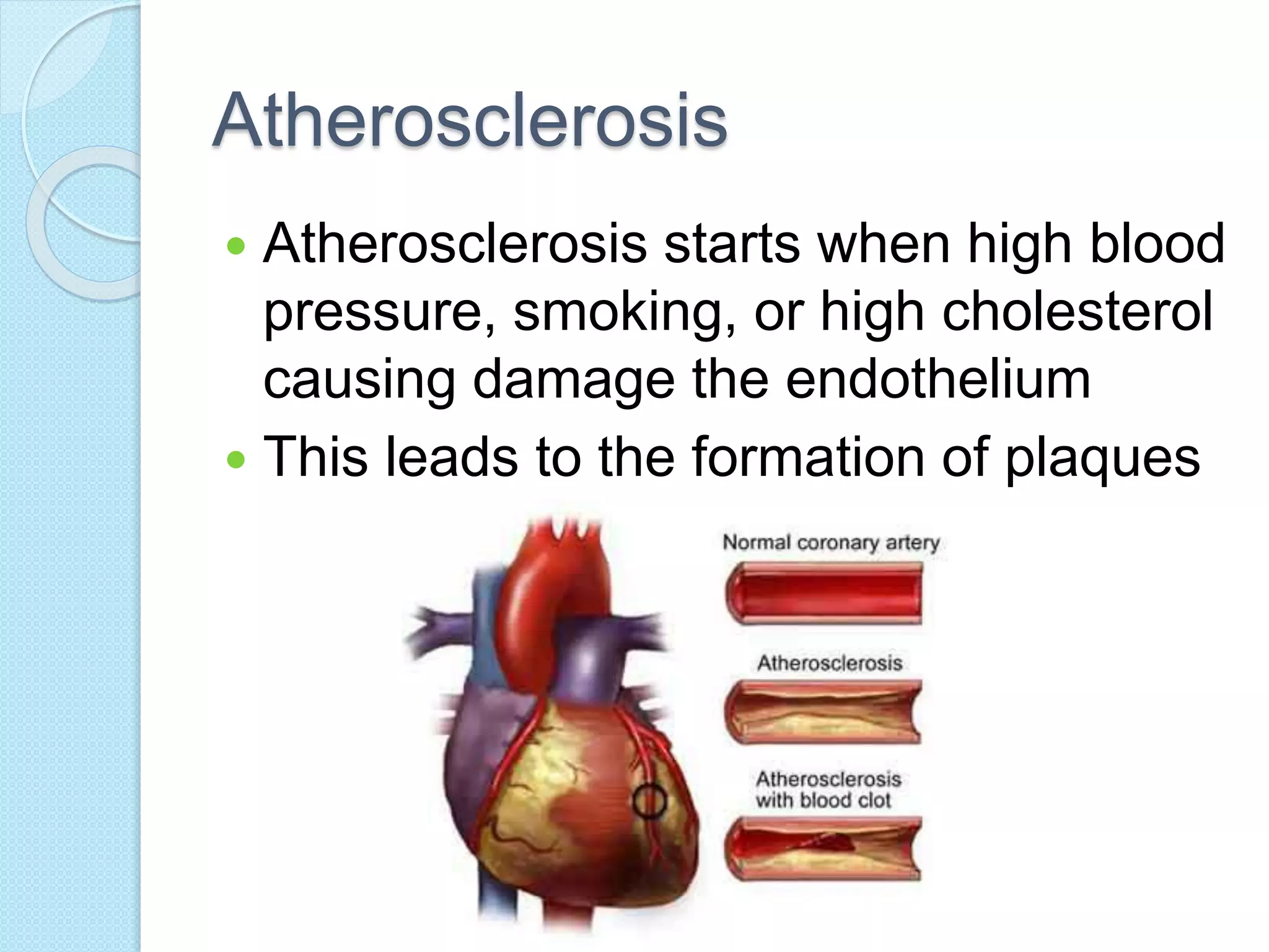 Atherosclerosis | PPTX
