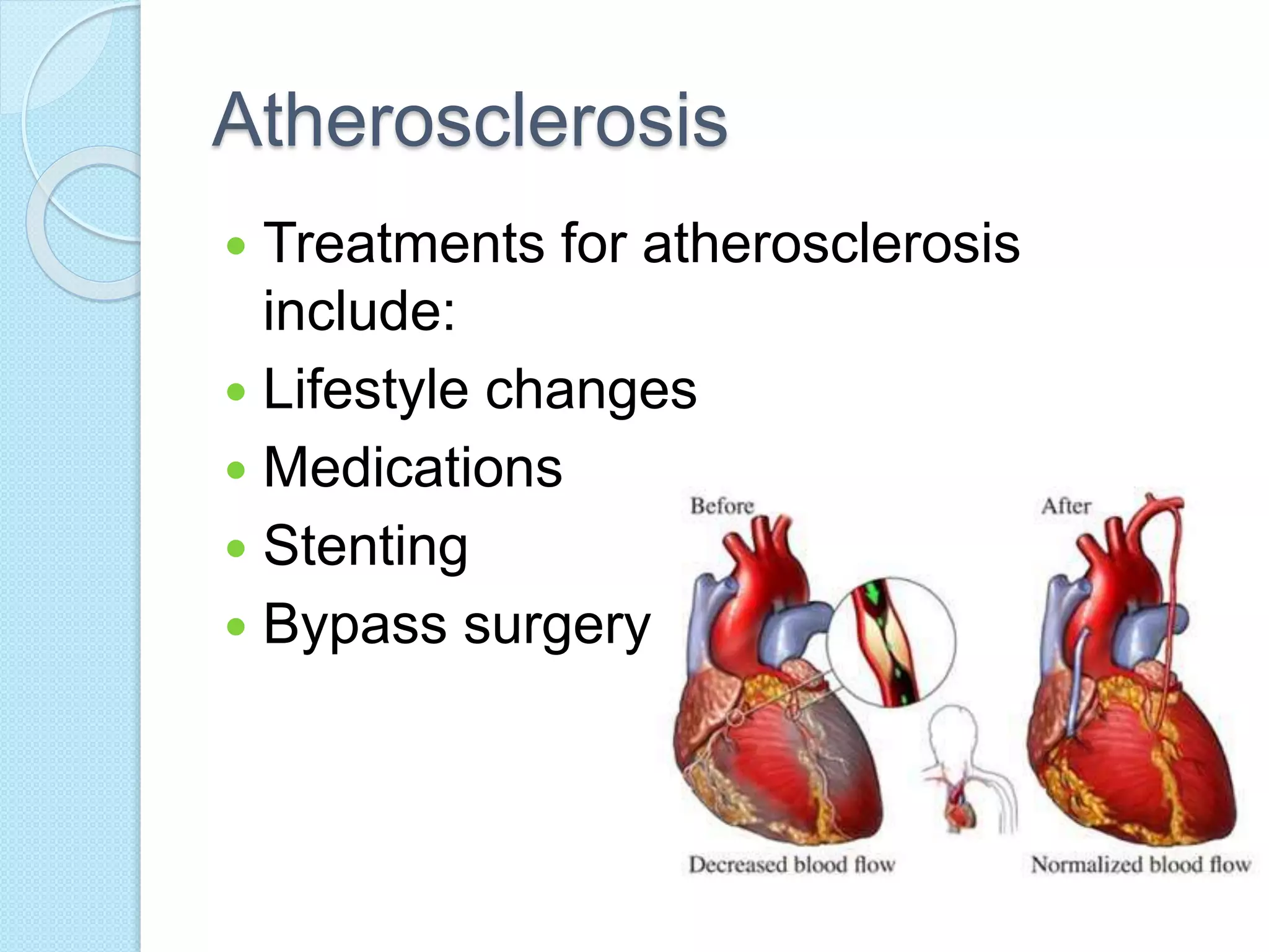 Atherosclerosis | PPTX
