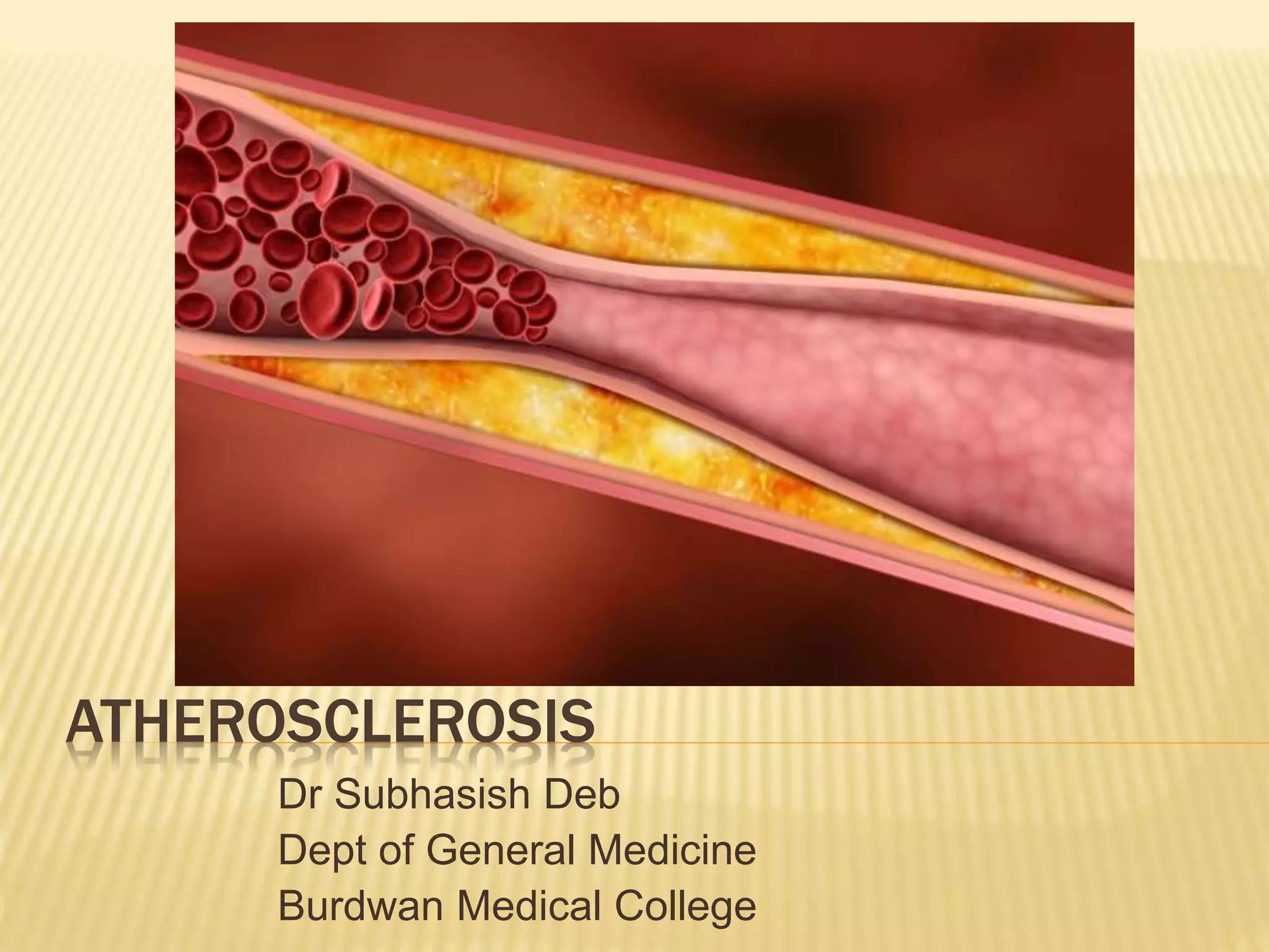 Atherosclerosis | PPTX | Heart and Cardiovascular Diseases | Diseases and Conditions