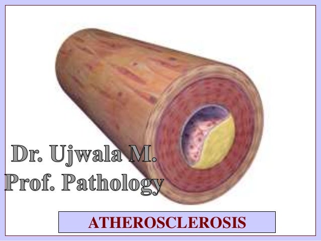 Atherosclerosis pathology mbbs