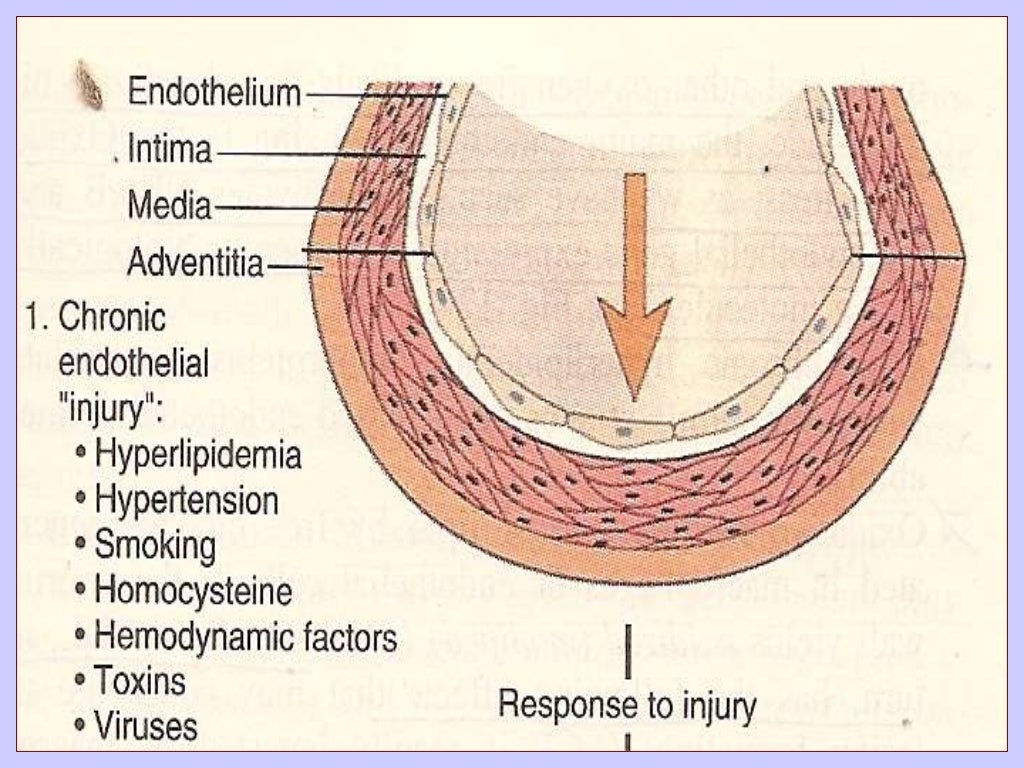 Atherosclerosis pathology mbbs