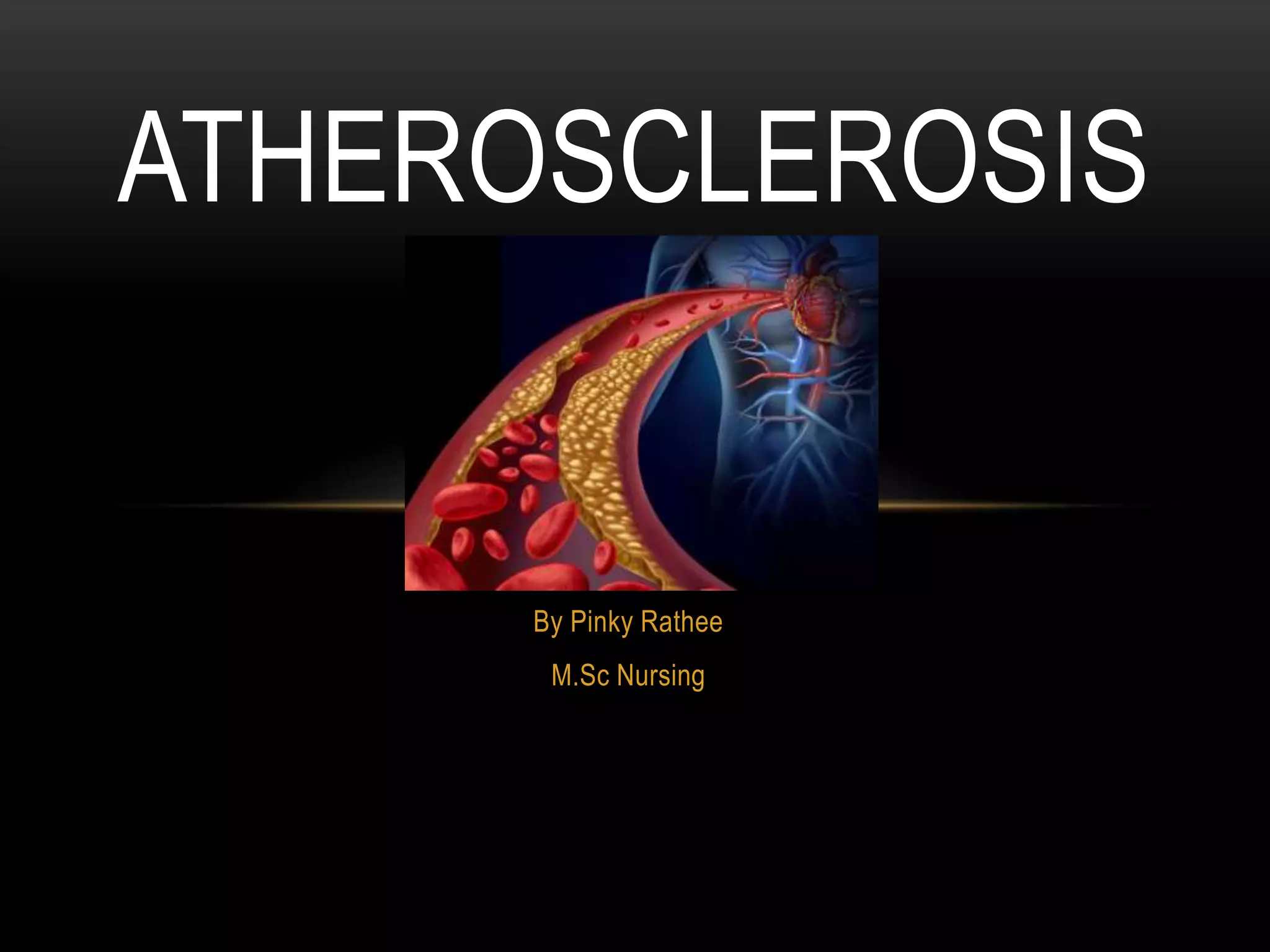 Atherosclerosis | PPTX