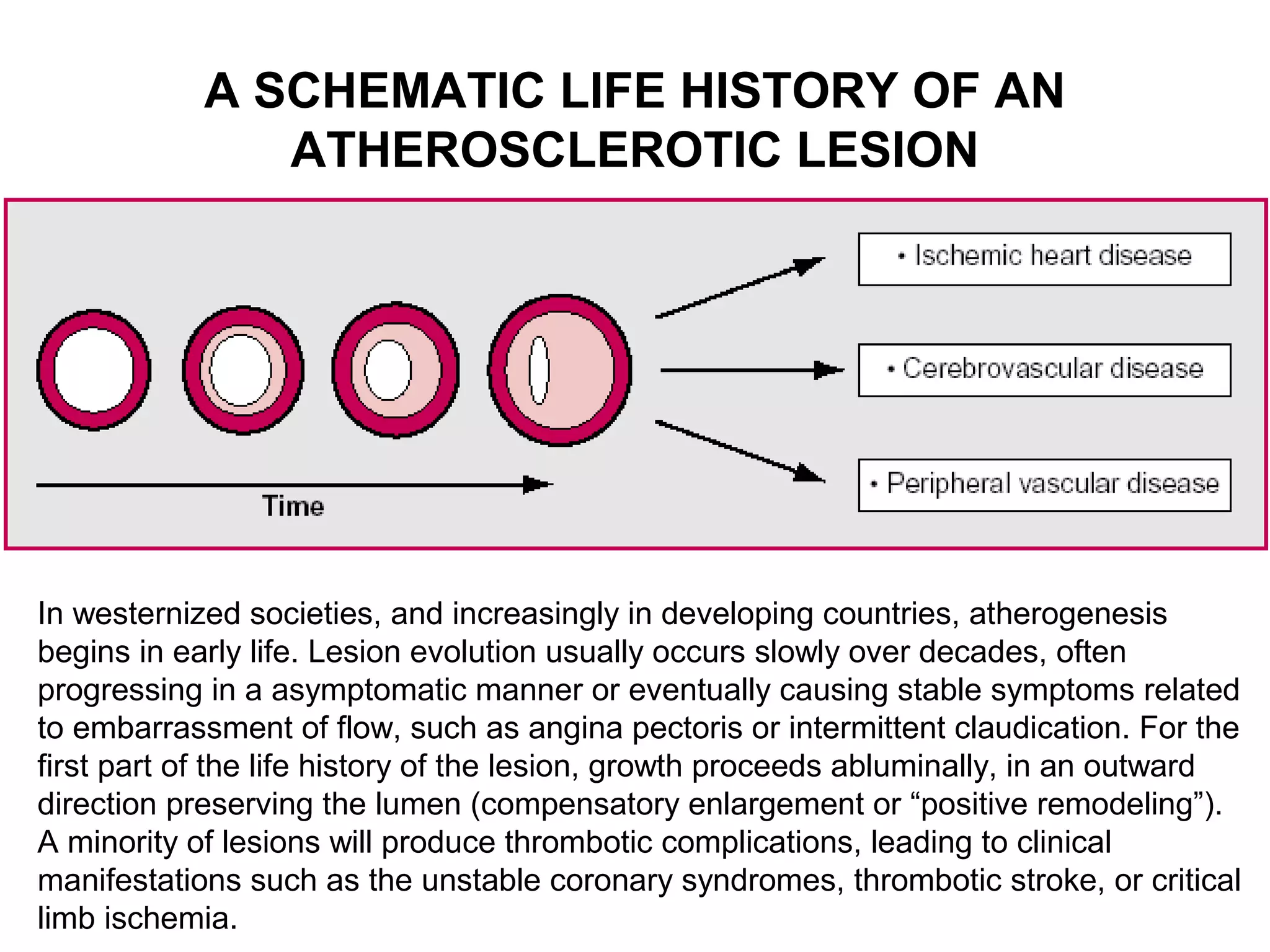 Atherosclerosis | PPT
