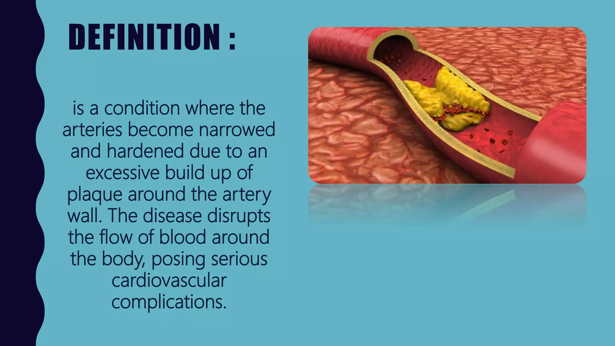 Atherosclerosis | PPT
