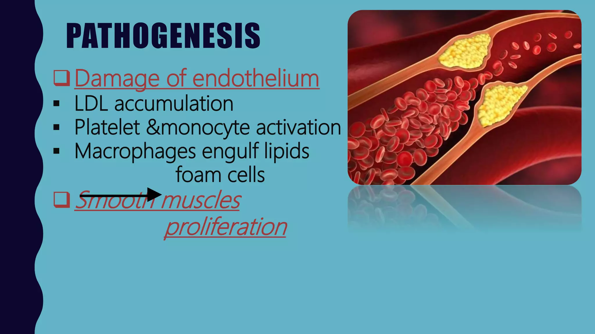 Atherosclerosis | PPTX