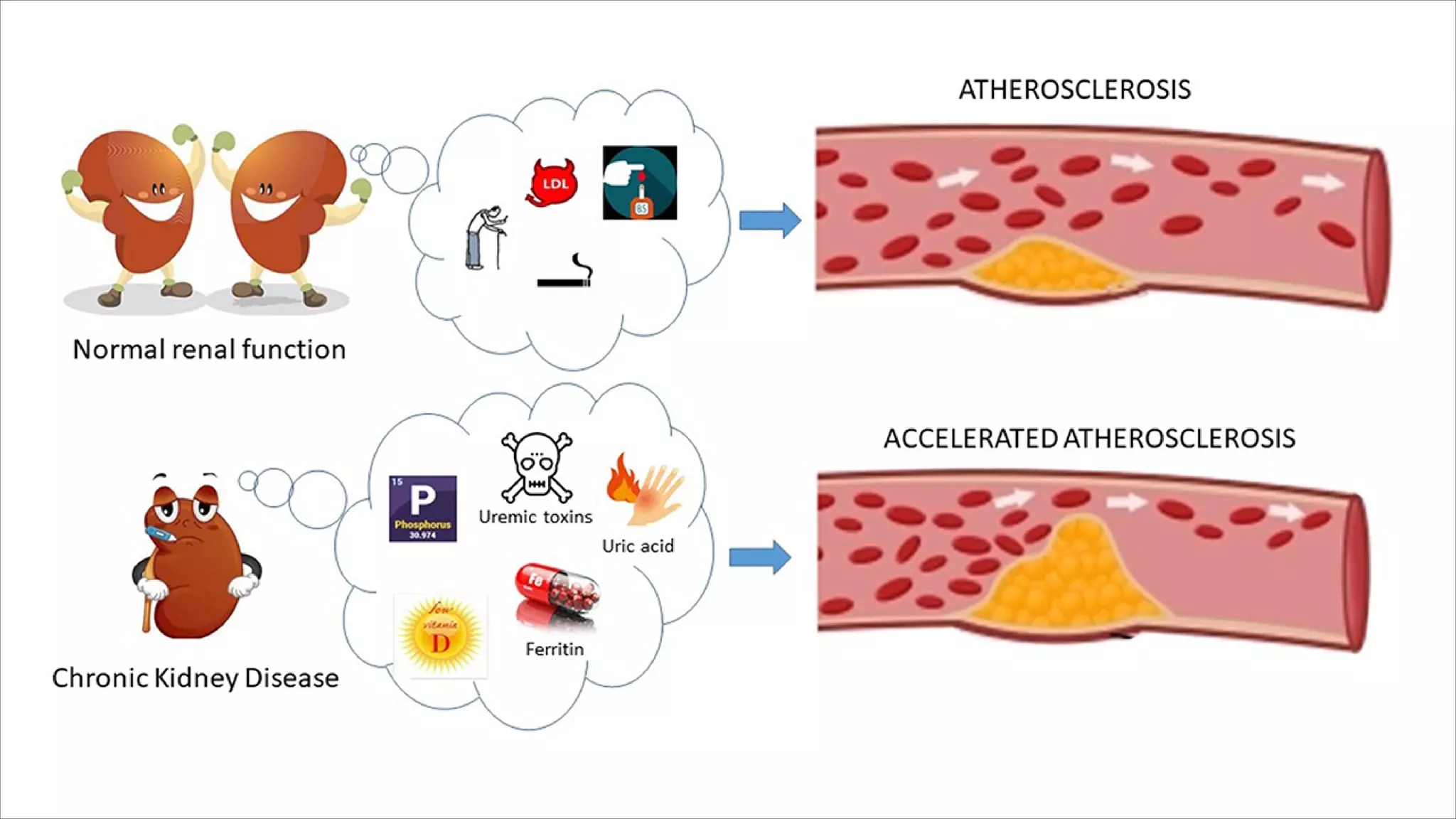 Atherosclerosis | PDF