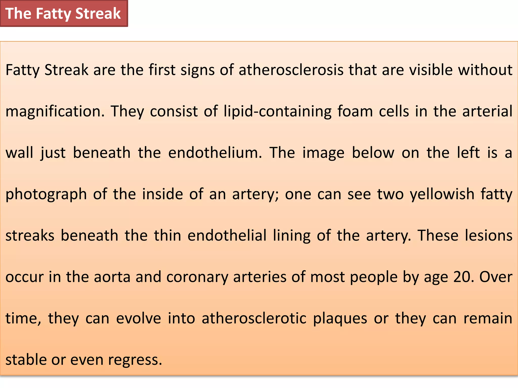 Atherosclerosis.pptx | Heart and Cardiovascular Diseases | Diseases and ...