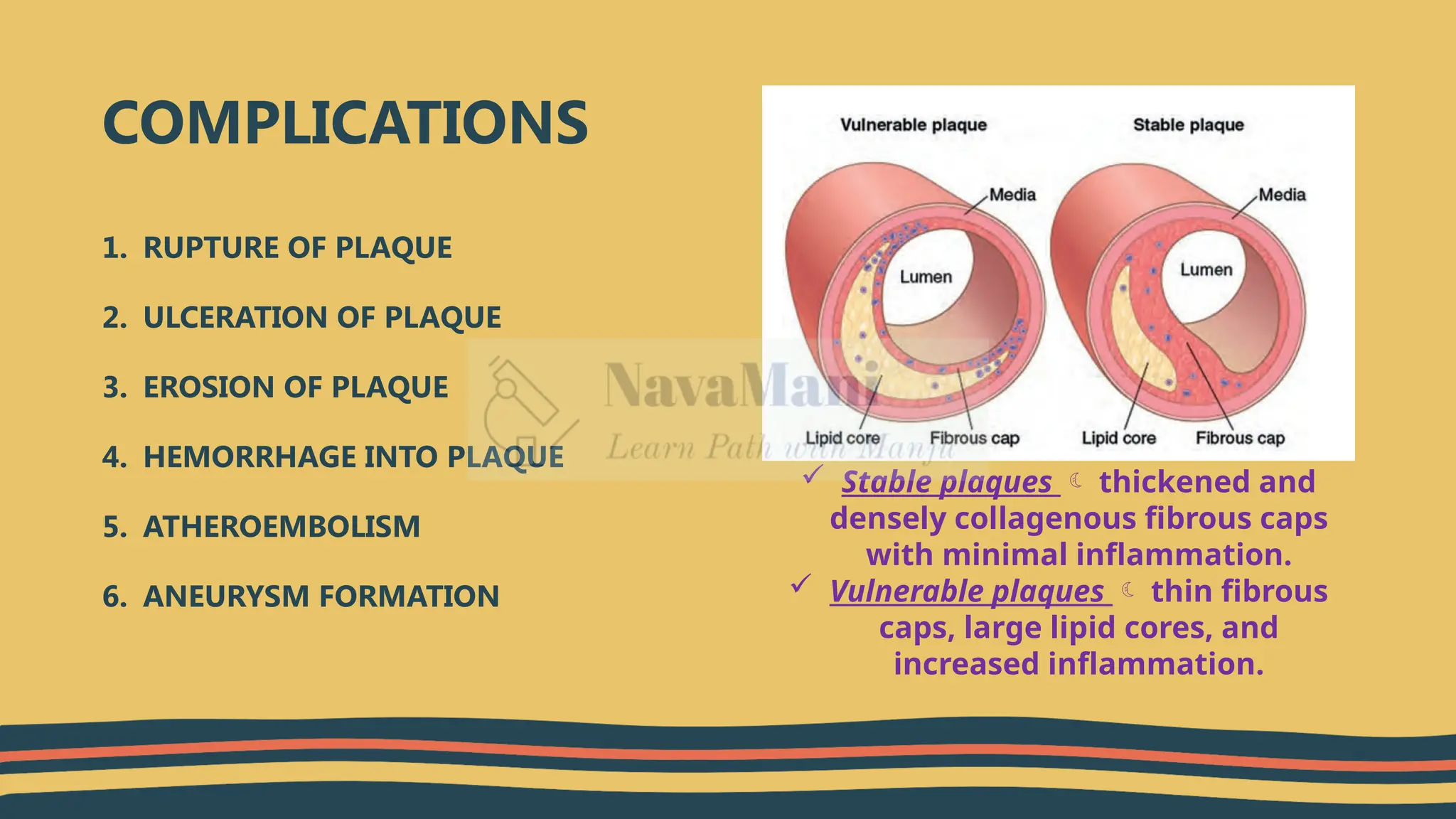 ATHEROSCLEROSIS .pptx