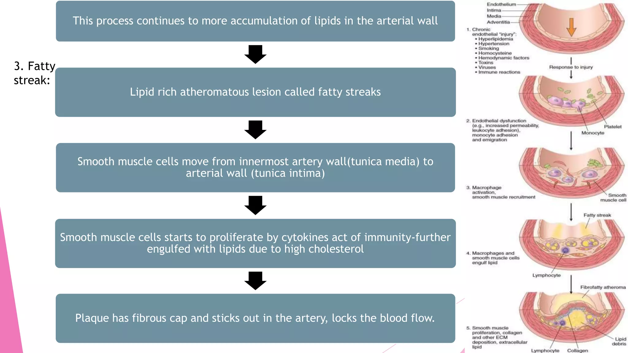 Atherosclerosis-All about Atherosclerosis,intoduction, causes ...