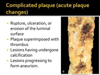 Atherosclerosis morphology | PPTX