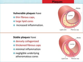 Lipid metabolism & Atherosclerosis -A Brief Review | PPTX