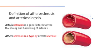 Atherosclerosis and arteriosclerosis .pdf