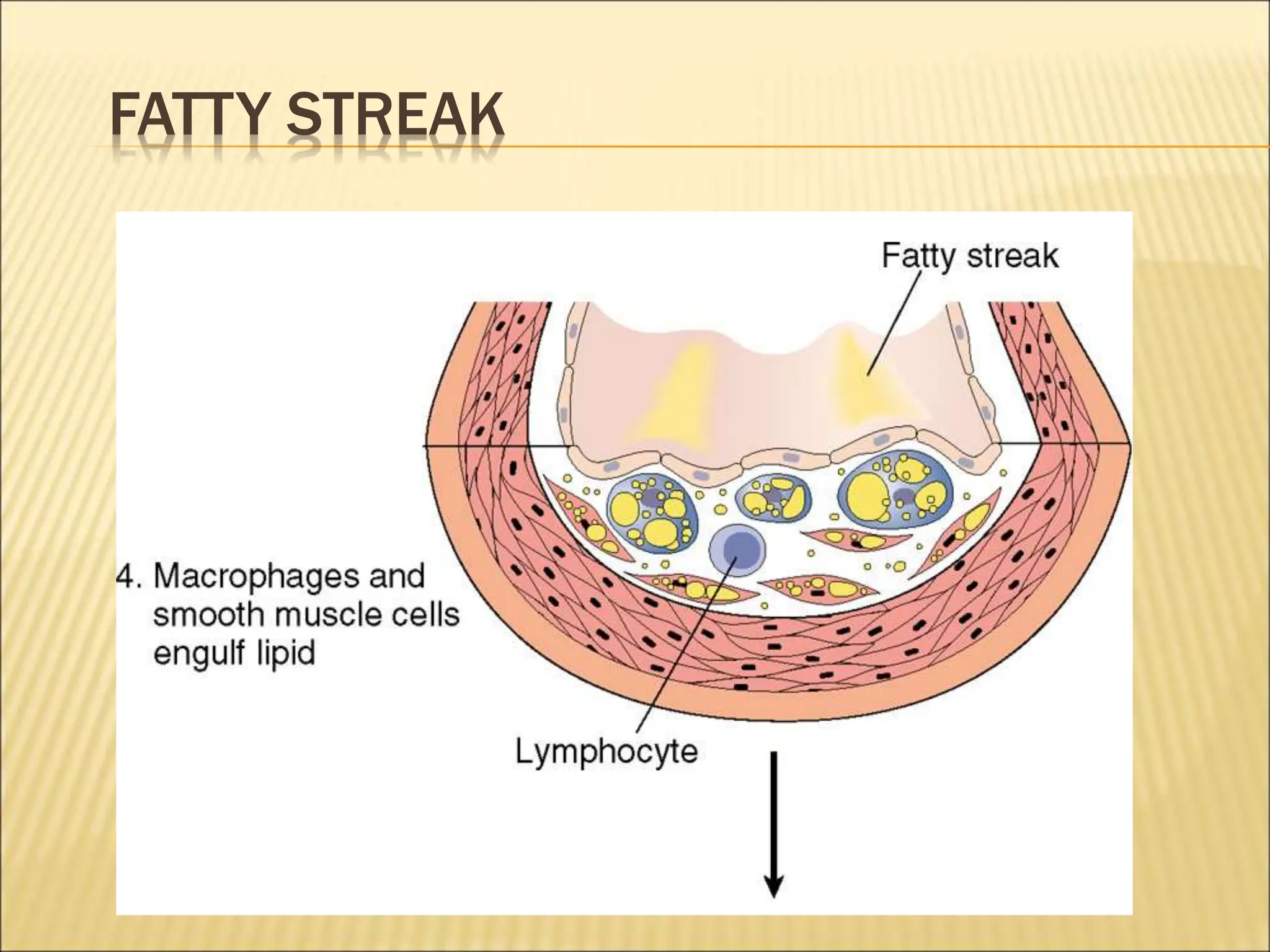 ATHEROSCLEROSIS & IHD.ppt