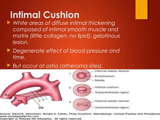 Atherosclerosis | PPT | Heart and Cardiovascular Diseases | Diseases ...