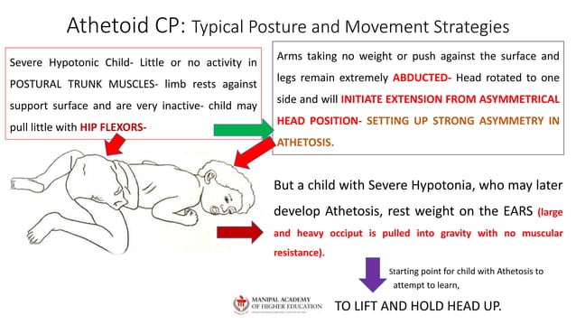 Athetoid CP- Therapy Strategies in CP.pptx