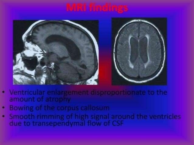 athira.s.pptx. neurology mri ct scan investigation and interpretation | PPTX