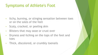 Athlete’s Foot Natural Treatment.pptx | Herbs and Supplements ...