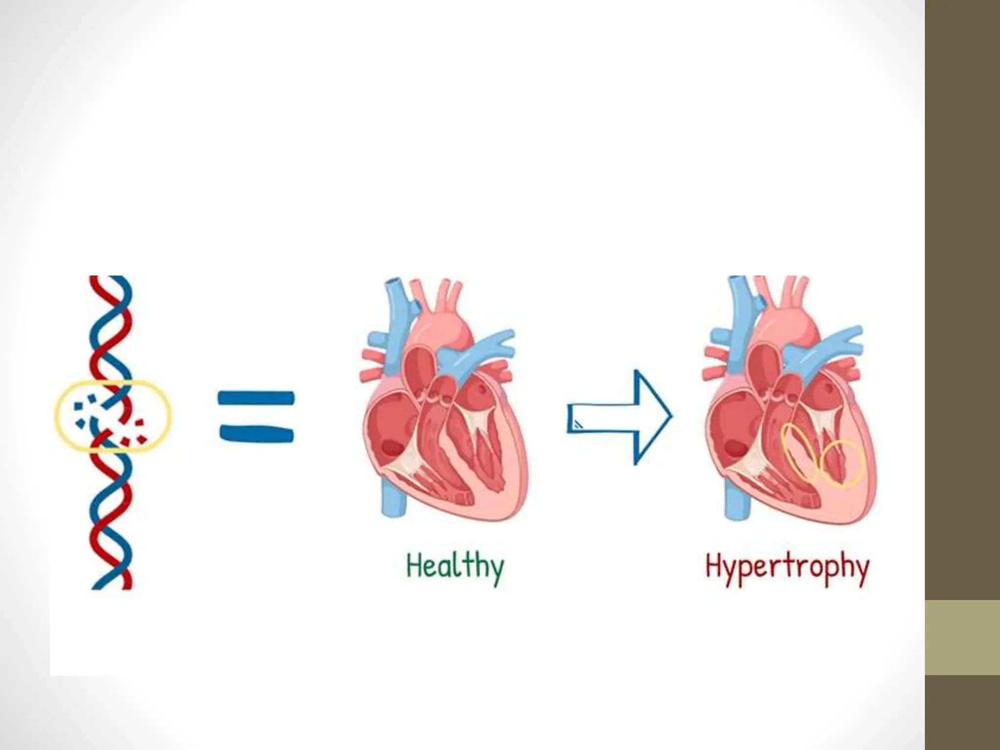 Athlete’s Heart physiotherapy (MPT).pptx