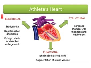 Athlete's Heart | PPT