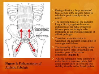 Athletic pubalgia | PPT