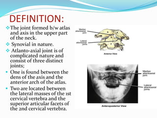Atlantoaxial and occipital joint | PPTX