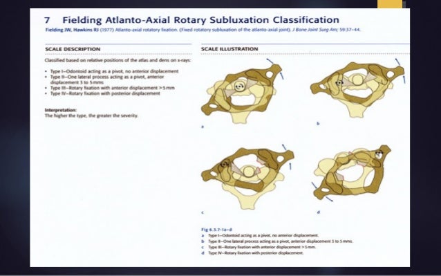 Atlanto-axial subluxation