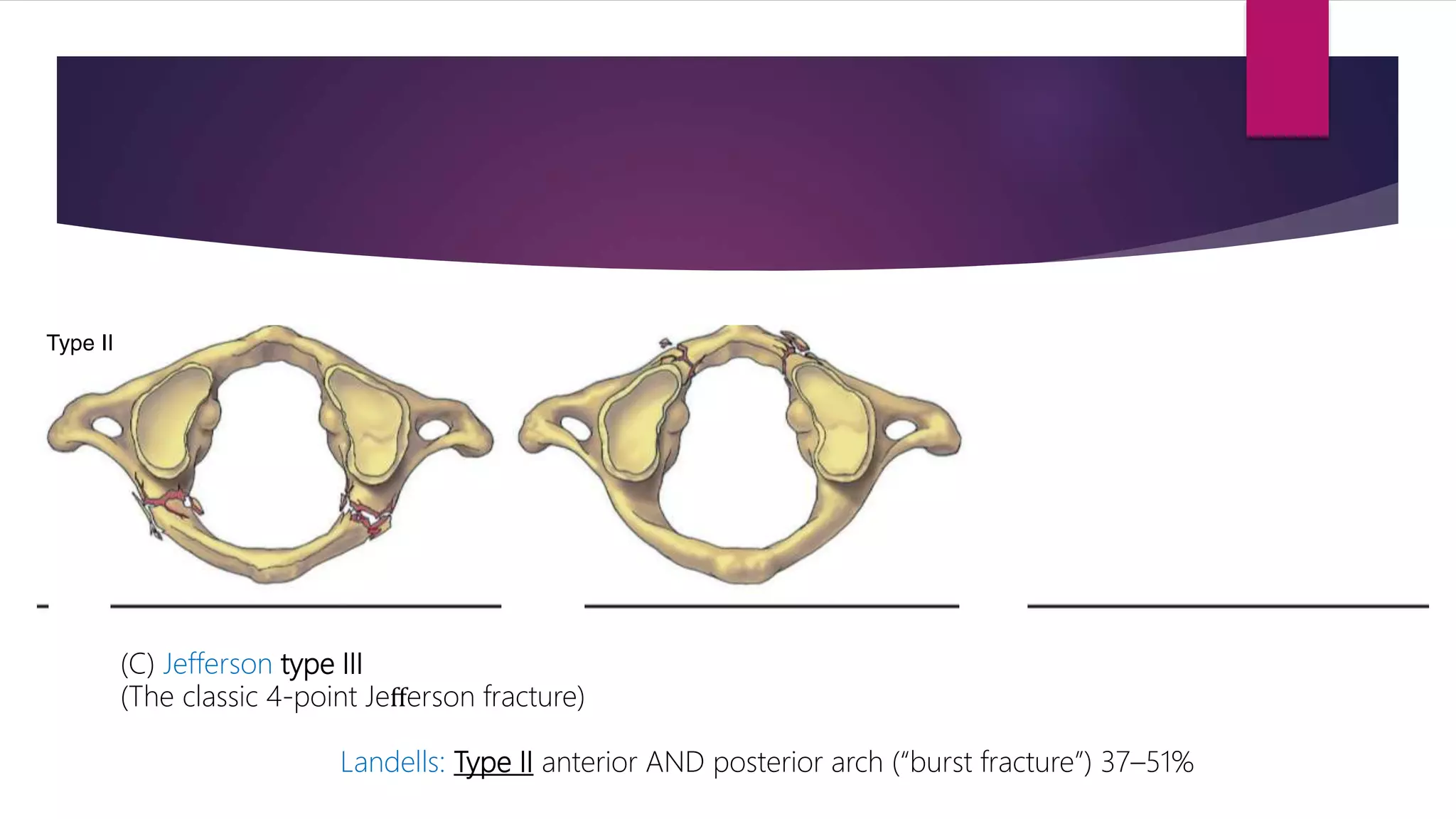 Atlantoaxial injuries | PPTX