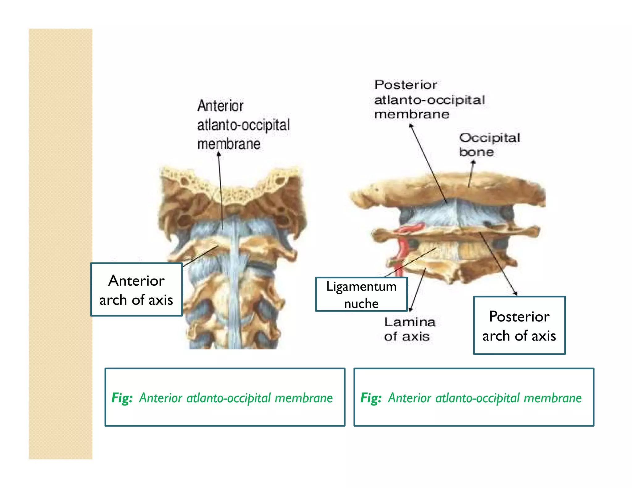 Atlanto occipital and atlanto axial joint | PDF