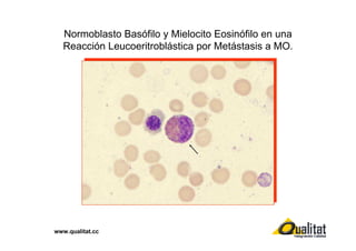 Atlas.hematologia | PDF