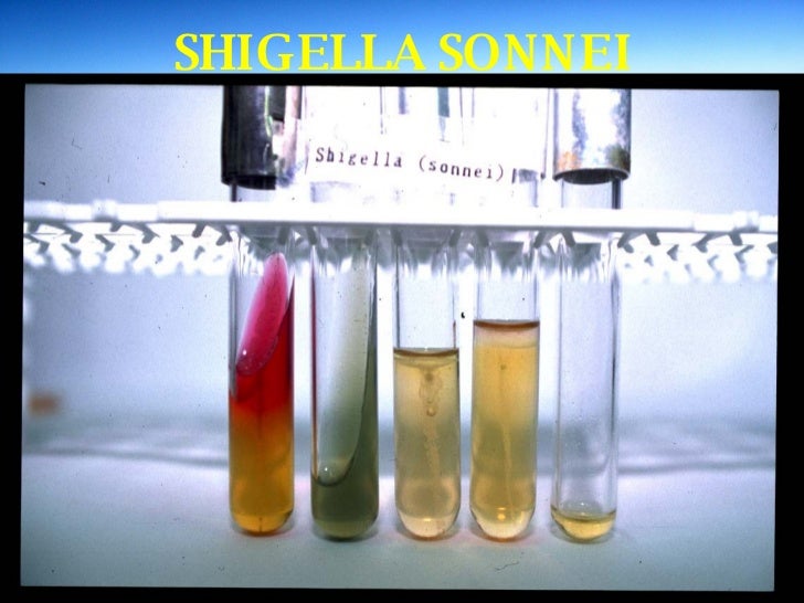 Atlas Microbiologia Clinica Pate I