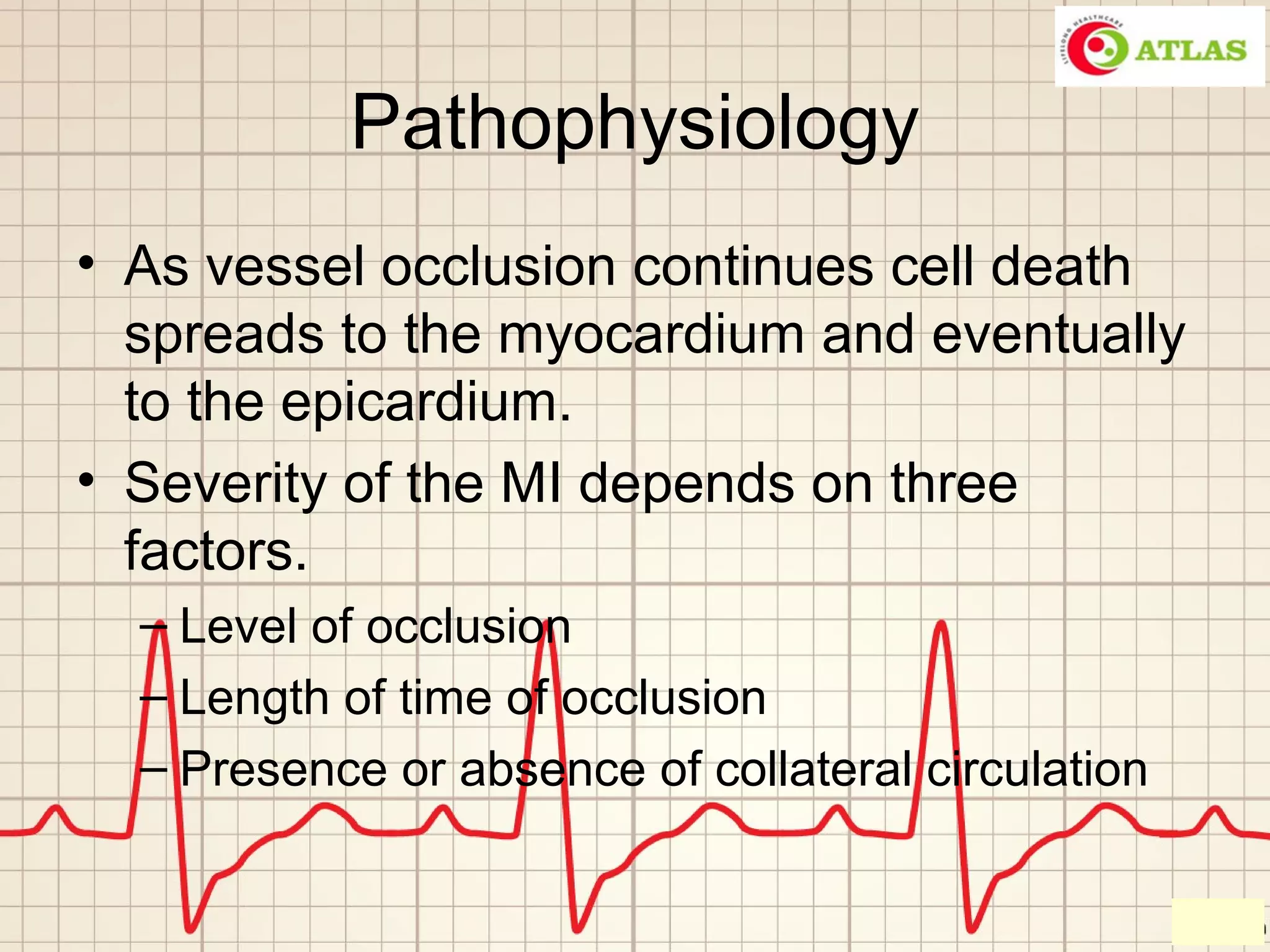 Atlas myocardialinfarction | PPT