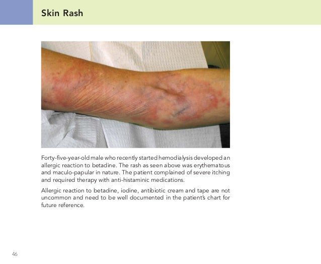 Dialysis Access Atlas