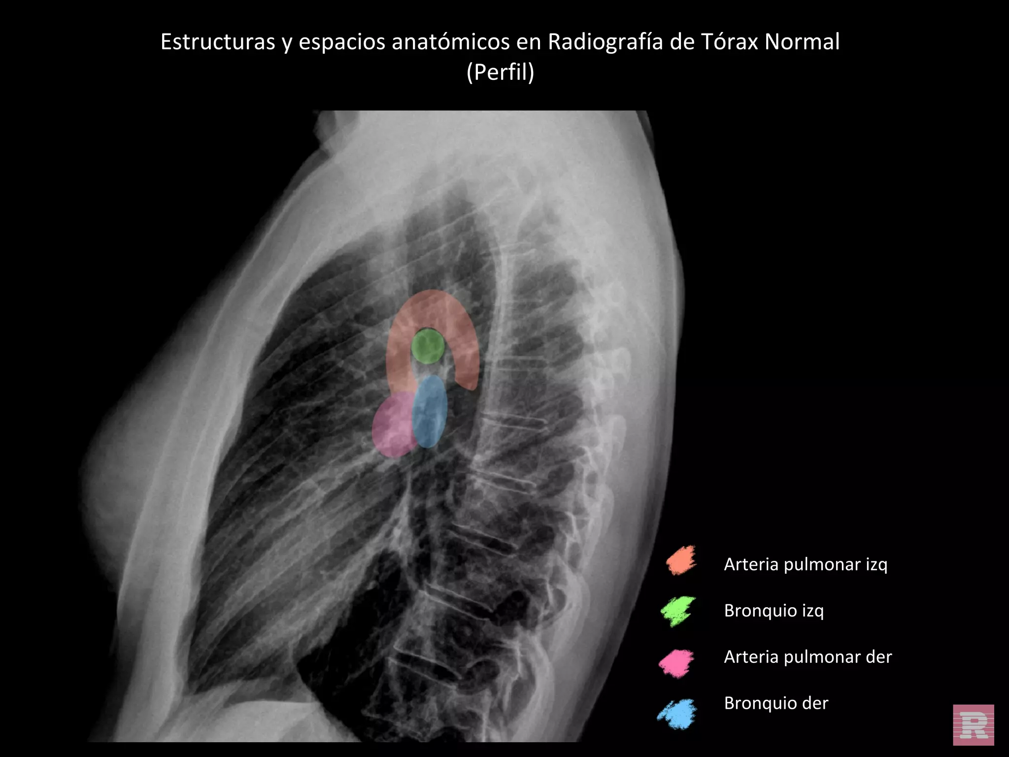 ATLAS ANATOMIA NORMAL TORAX .pptx (1).pdf