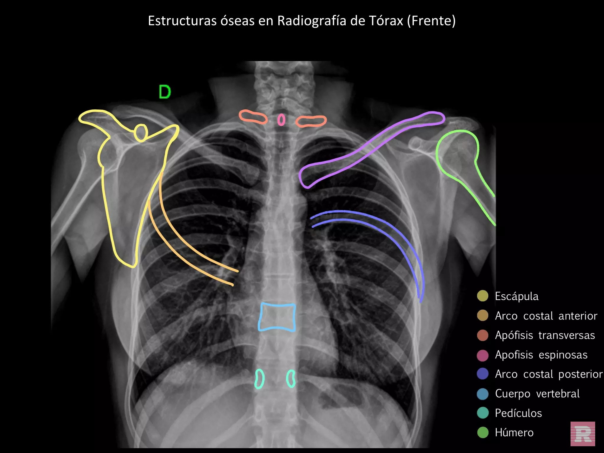 ATLAS ANATOMIA NORMAL TORAX .pptx (1).pdf