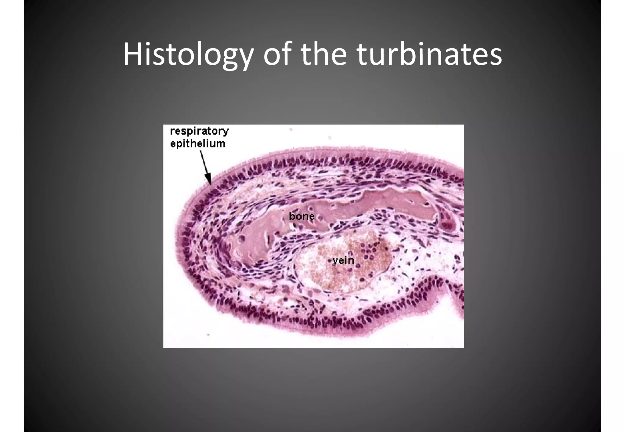 Atlas anatomy of the nose and paranasal sinuses | PDF