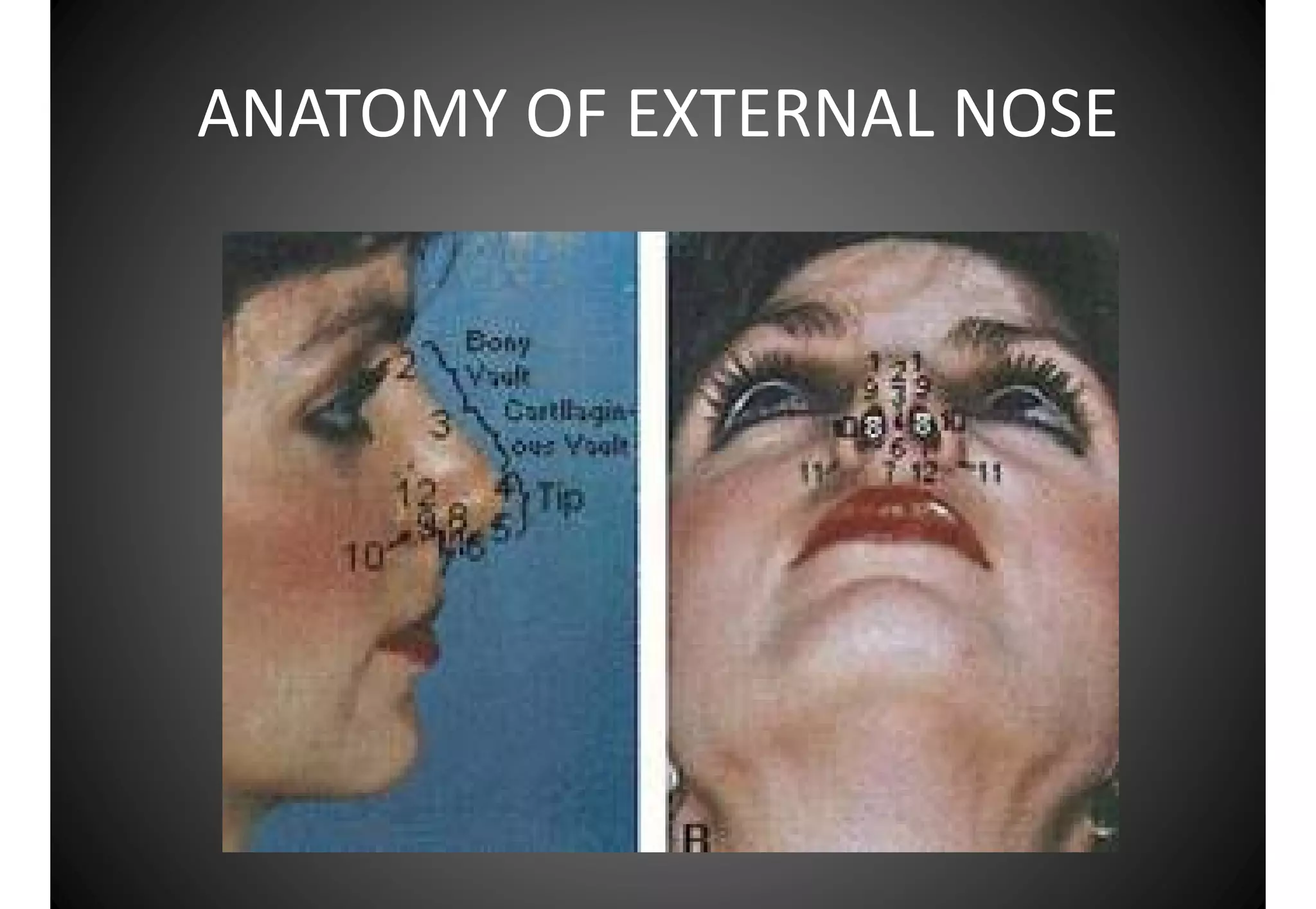 Atlas anatomy of the nose and paranasal sinuses | PDF