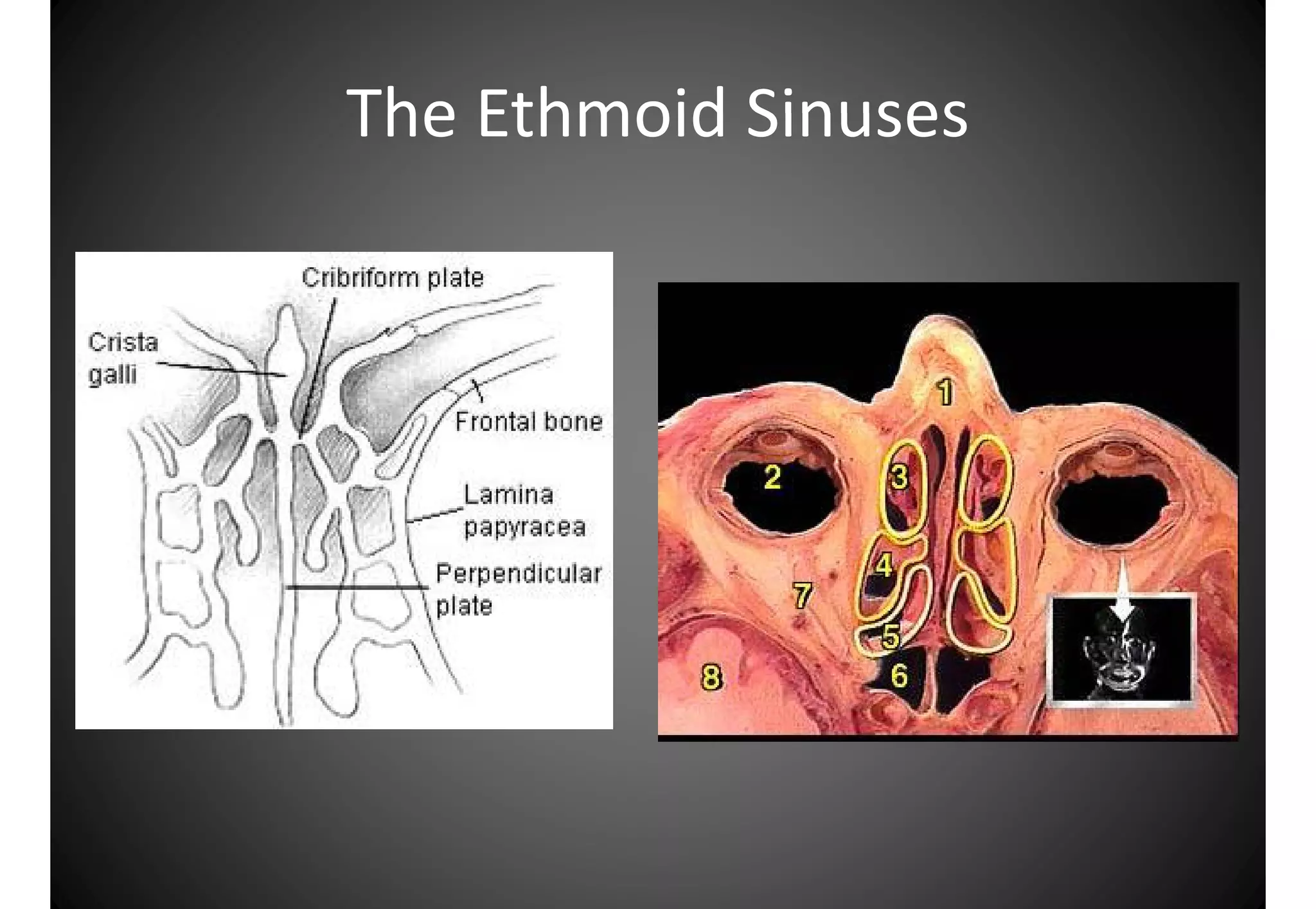 Atlas anatomy of the nose and paranasal sinuses | PDF