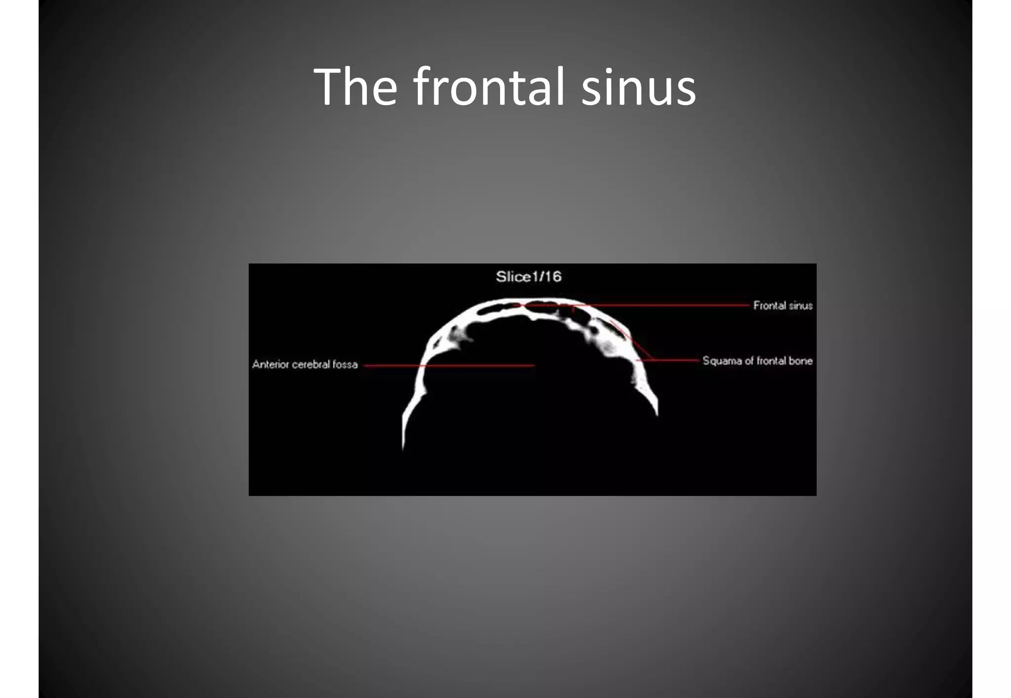 Atlas anatomy of the nose and paranasal sinuses | PDF
