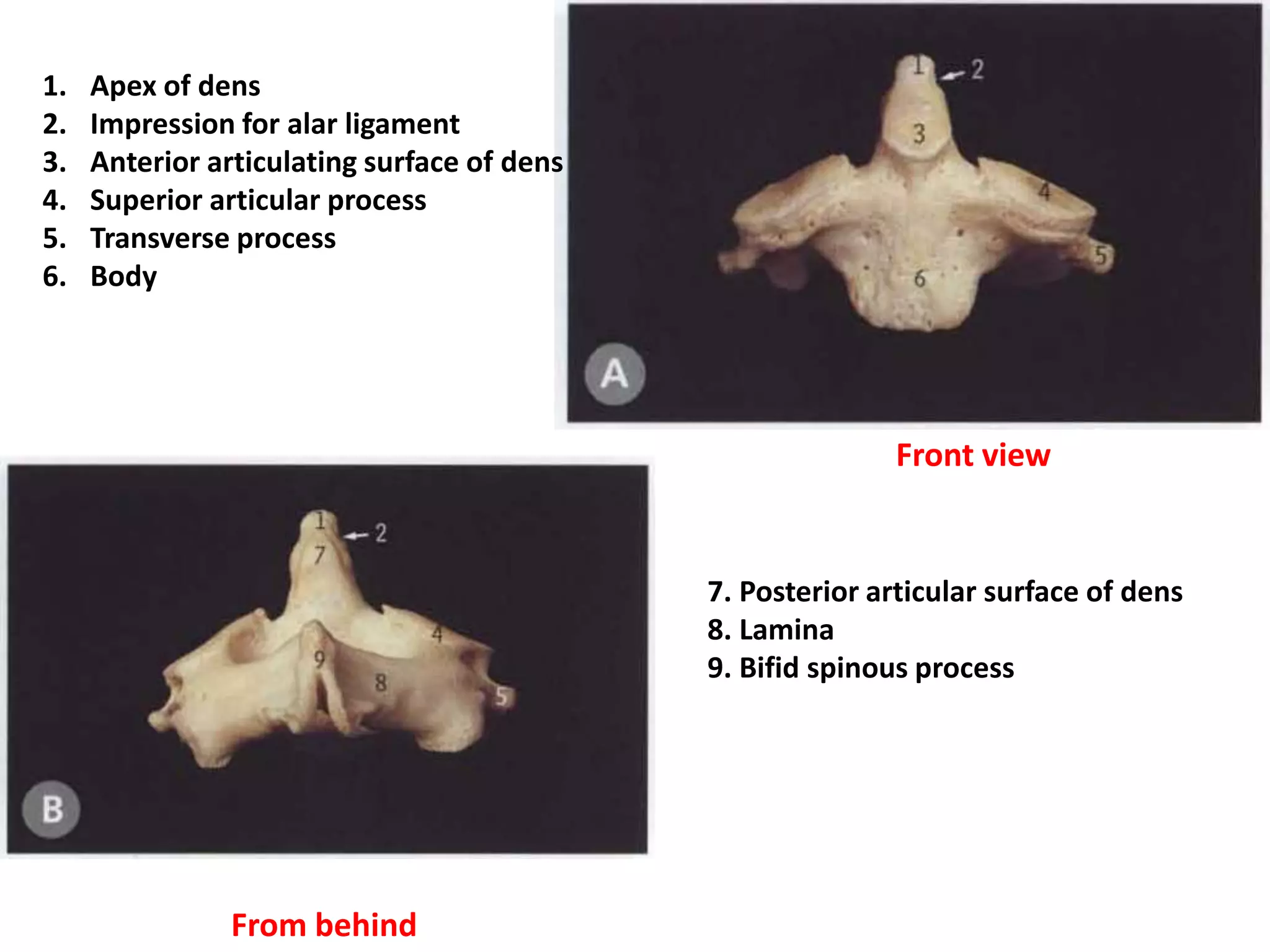 Atlas(C1) & Axis(C2) Vertebrae.pptx