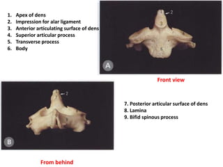 Atlas(C1) & Axis(C2) Vertebrae.pptx
