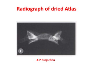 Atlas(C1) & Axis(C2) Vertebrae.pptx